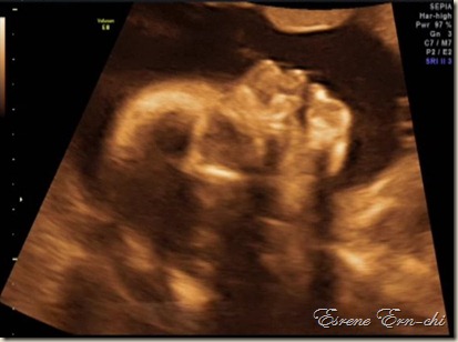 Baby Siu Life Story: Pregnancy Update (Mommy’s Journal)